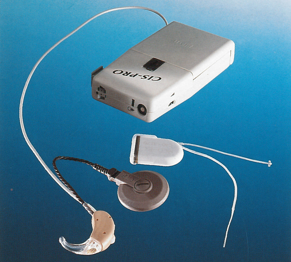Cochlear implant audio processor upgrade - lifelonghearing.com